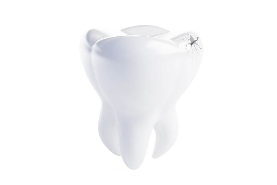 My Front Tooth Cracked — Can It Be Fixed? - Empire Dental Care